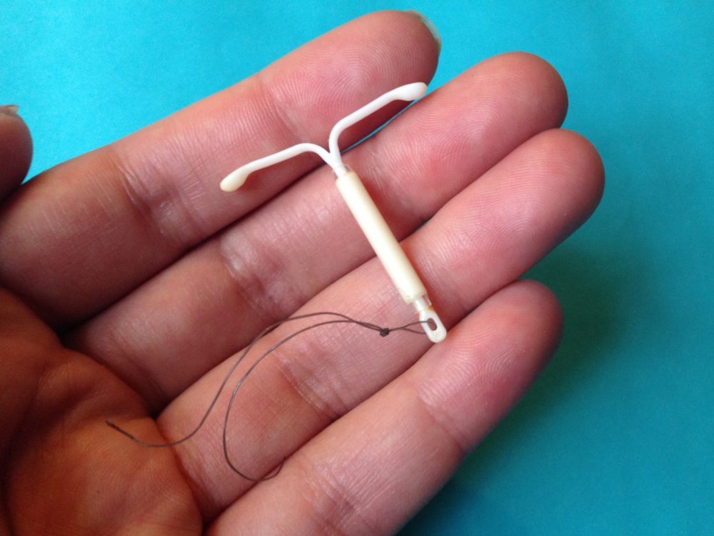 IUD placement - Punit Fertility & Women's Center